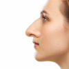 Rhinoplasty, nose surgery simulation - Surgical simulator before/after