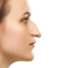 Rhinoplasty, nose surgery simulation - Surgical simulator before/after