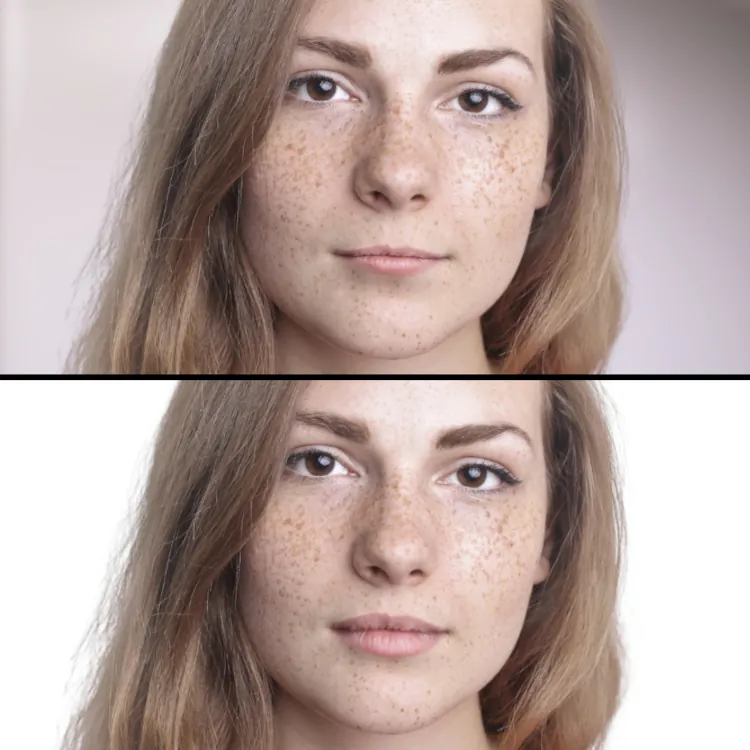 Lips surgery - Surgical simulator before/after