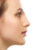 Rhinoplasty, nose surgery simulation - Surgical simulator before/after