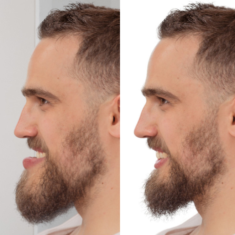 Cosmetic surgery simulator - Surgical simulator before/after